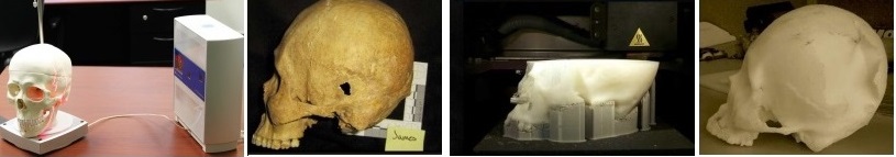 Computational Forensics: Digital Skull Restoration and Facial ...